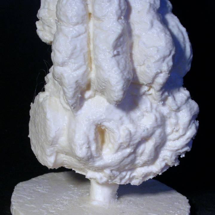 3D Printable A Severed Head at The Nye Carlsberg Glyptotek, Copenhagen ...