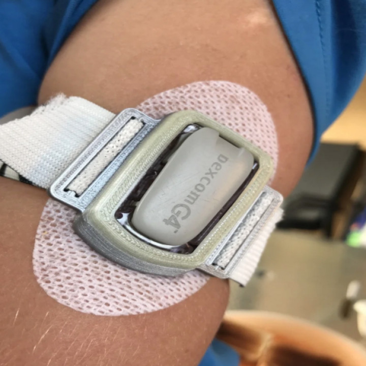 3D Printable Dexcom G4/G5 cover by Martin Kolar