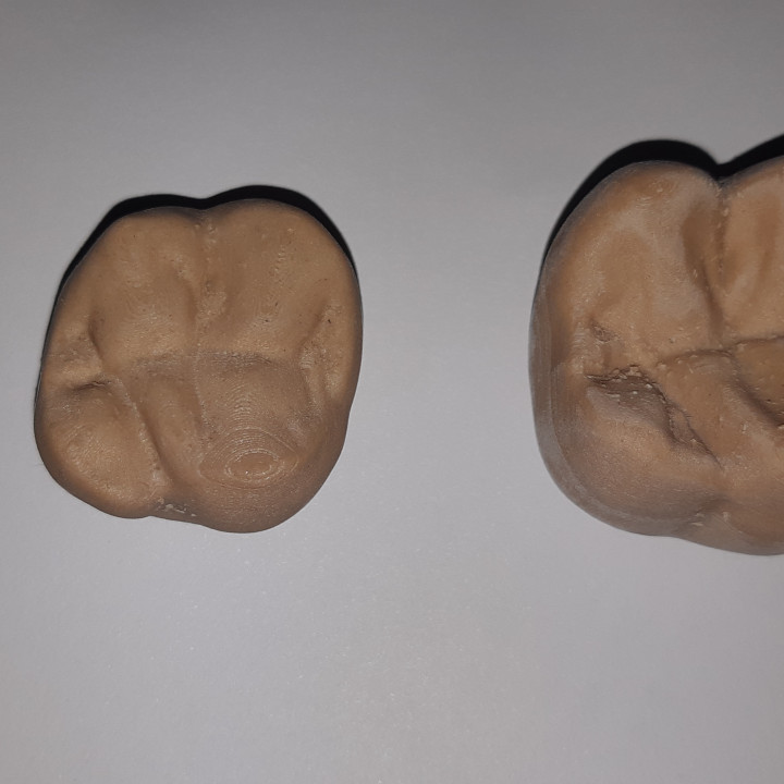 3D Printable Maxillary Molar by hussein