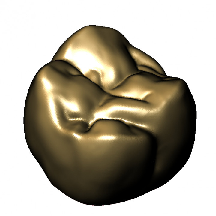 3D Printable Maxillary Molar by hussein