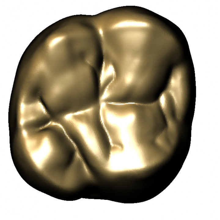 3D Printable Maxillary Molar by hussein