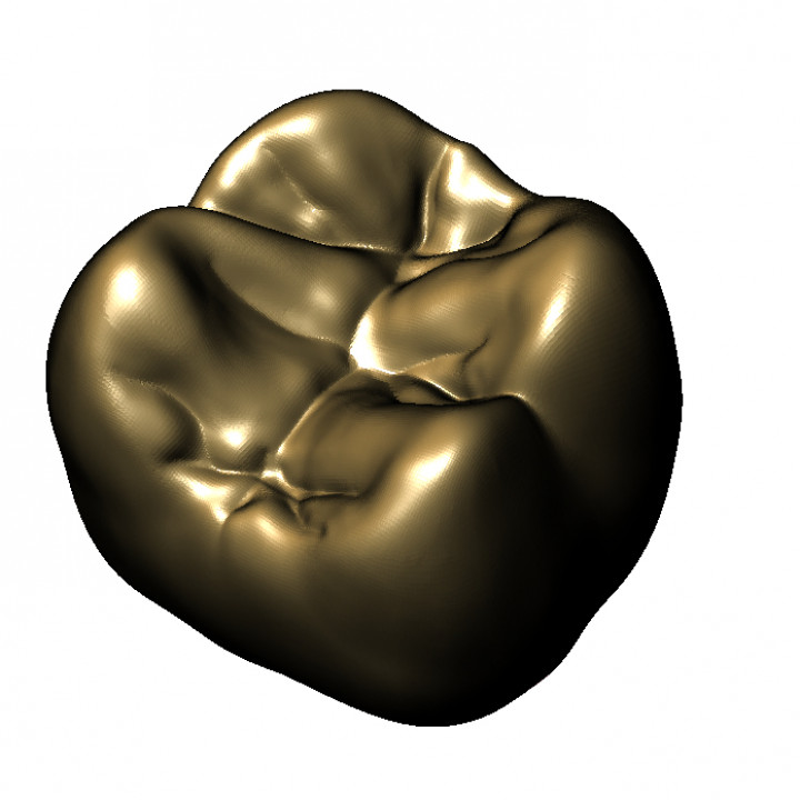 3D Printable Maxillary Molar by hussein