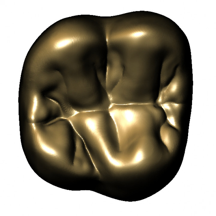 3D Printable Maxillary Molar by hussein