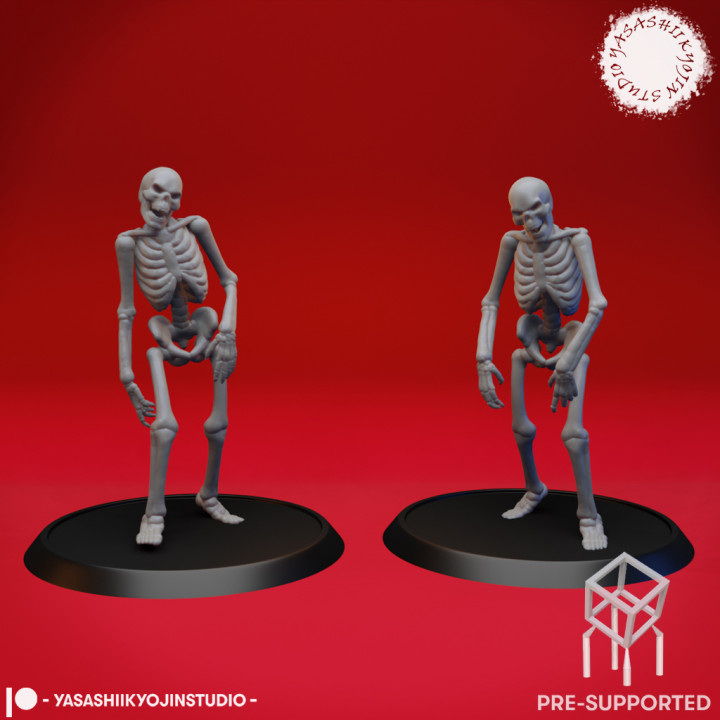 3D Printable Undead Skeleton Walkers - Tabletop Miniature (Pre ...