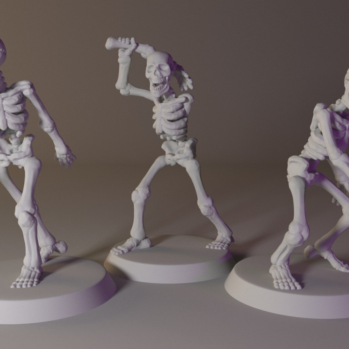 3D Printable Skeleton Set !SUPPORTED! !FREE! by Stormforge Miniatures