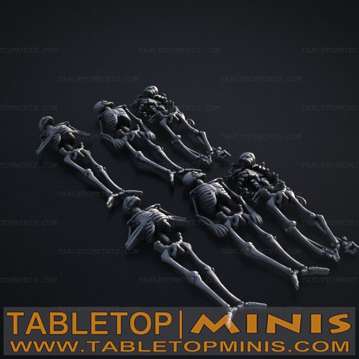 3D Printable Corpse Skeleton by TableTopMinis