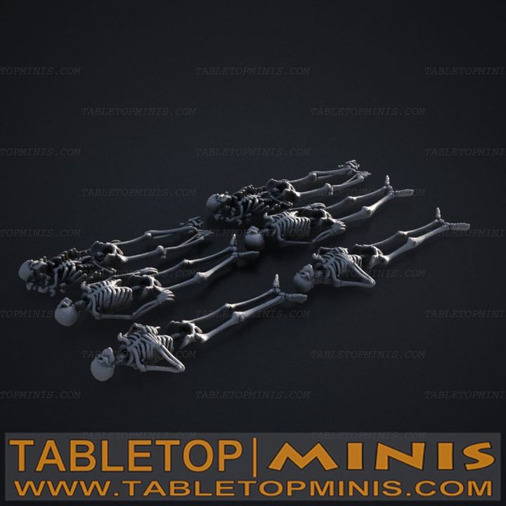 3D Printable Corpse Skeleton by TableTopMinis
