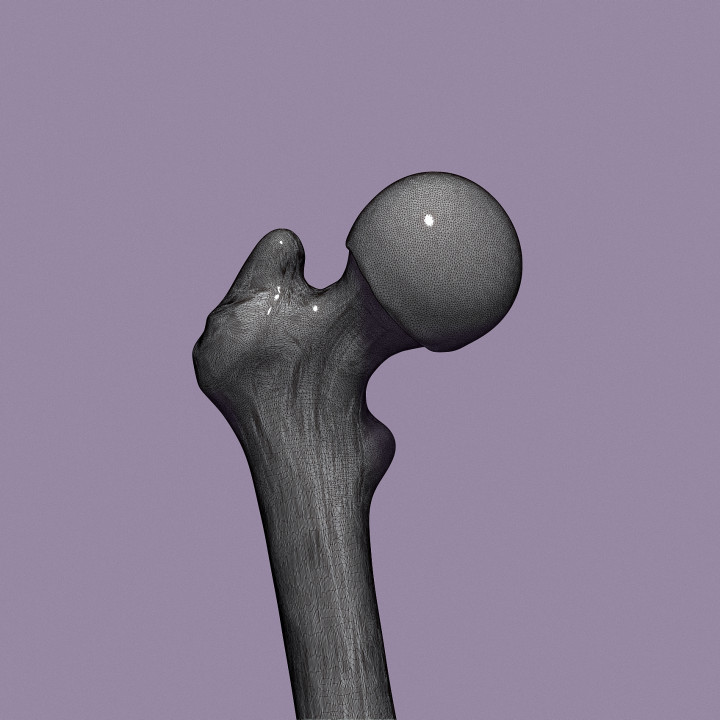 3D Printable human femur by Viktoriya Kabanova