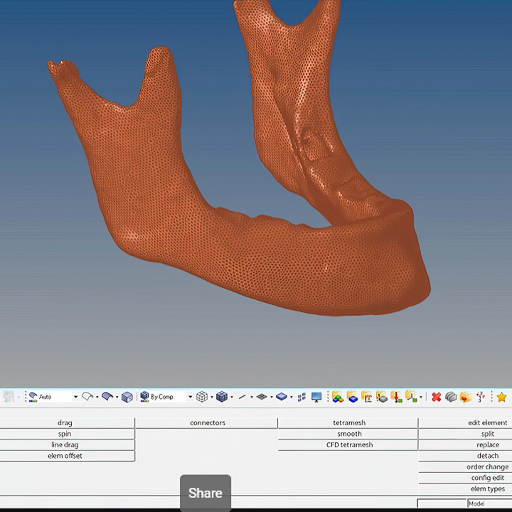 3D Printable convert your CT / MRI scans to 3d printable file by Asem ...