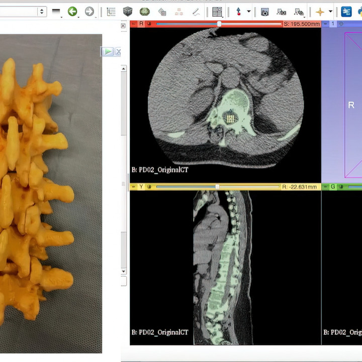 3D Printable convert your CT / MRI scans to 3d printable file by Asem ...