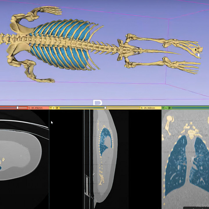 3D Printable convert your CT / MRI scans to 3d printable file by Asem ...
