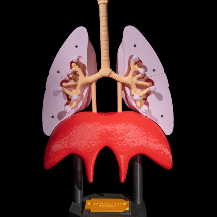3D Printable Lung Anatomical Model by Stlflix
