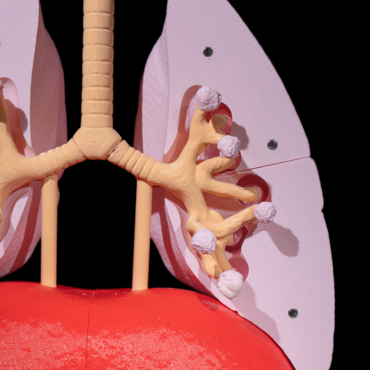 3D Printable Lung Anatomical Model by Stlflix