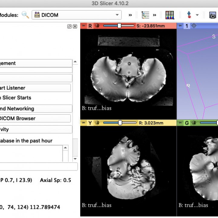 3D Printable Dolphin Brain MRI scan by Daniel Villegas
