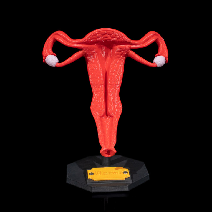 3D Printable Uterus by Stlflix