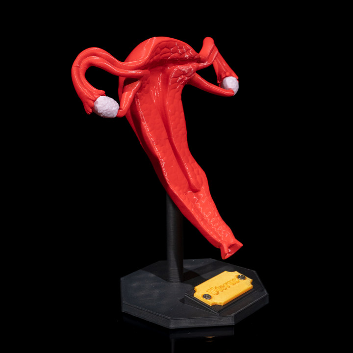 3D Printable Uterus by Stlflix