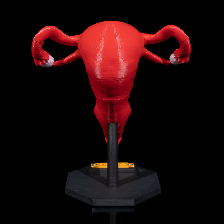 3D Printable Uterus by Stlflix