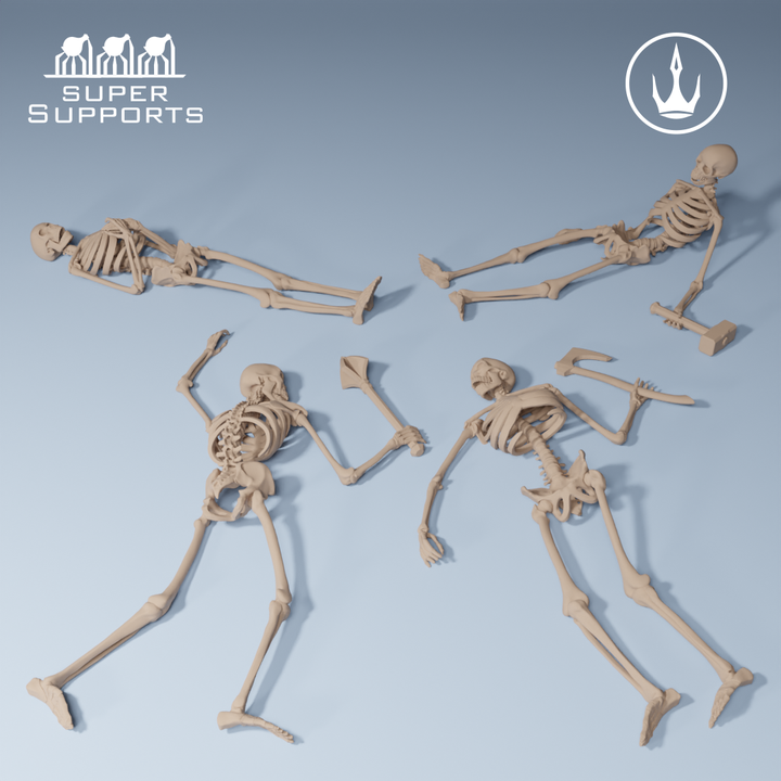 3D Printable Human skeleton poses 1-4 by The King of Bits