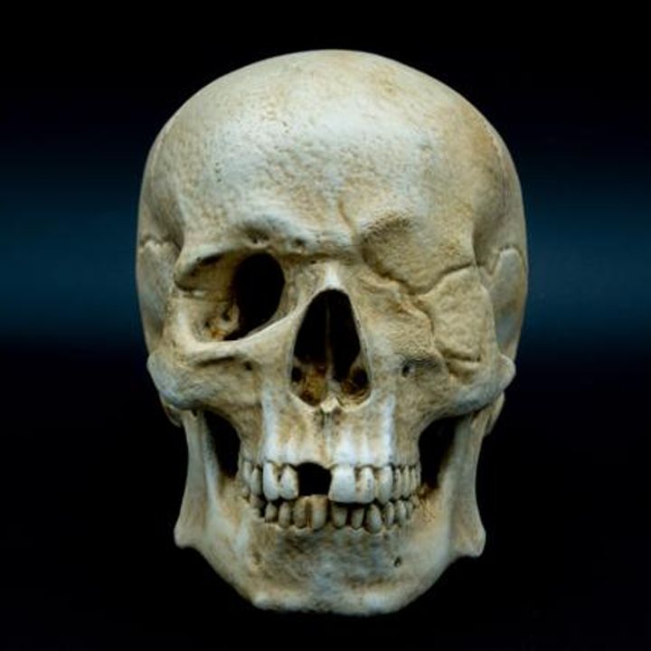 3D Printable One-Eyed Willy Skull from Goonies by Lantern Lore