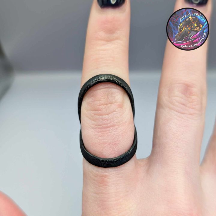 3D Printable Ring Splint for Hypermobility by Kirsten M