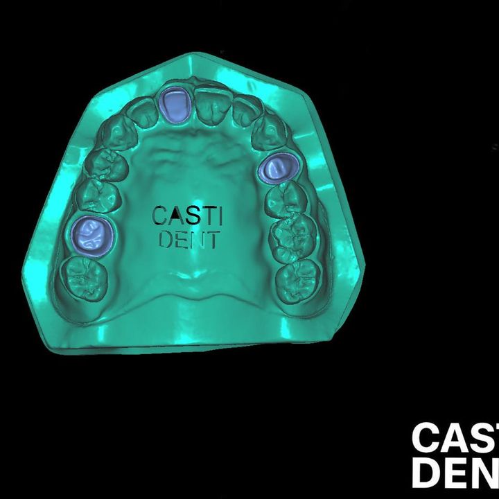 3D Printable Tooth Preparation Models – Central, Premolar, Molar | Cut ...