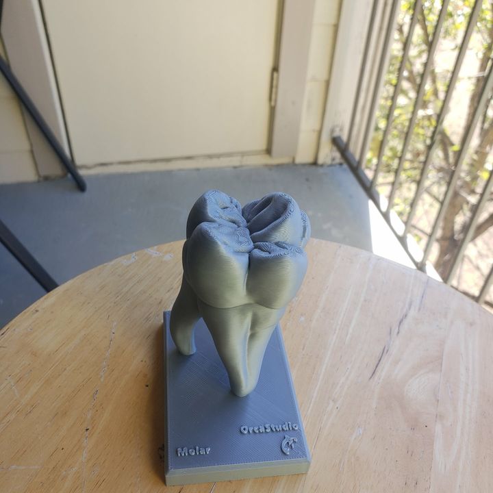 3D Printable Anatomy of Moral Tooth by Mansour Elamilk